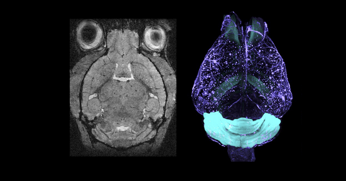 Researchers launch brain imaging platform with $2.9M boost from Brain ...