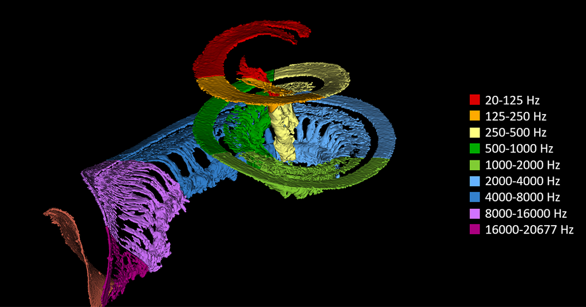 Feature: Pitch perfect - New tool helps to ‘tune’ cochlear implants to ...