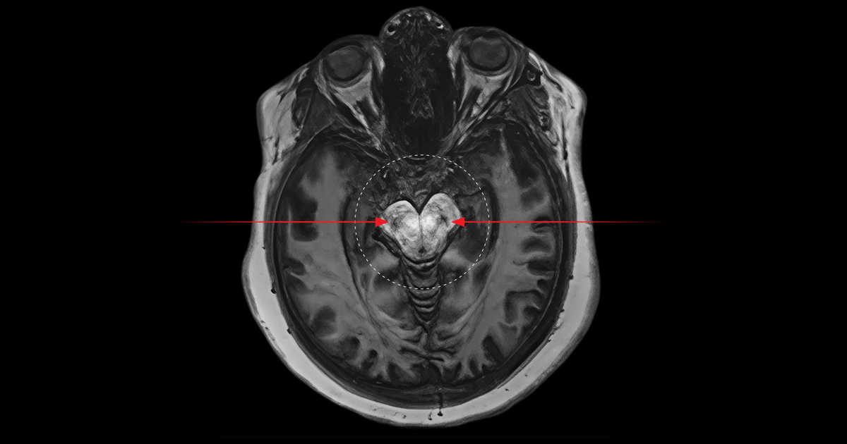 New study reveals potential biological link between cannabis use and ...