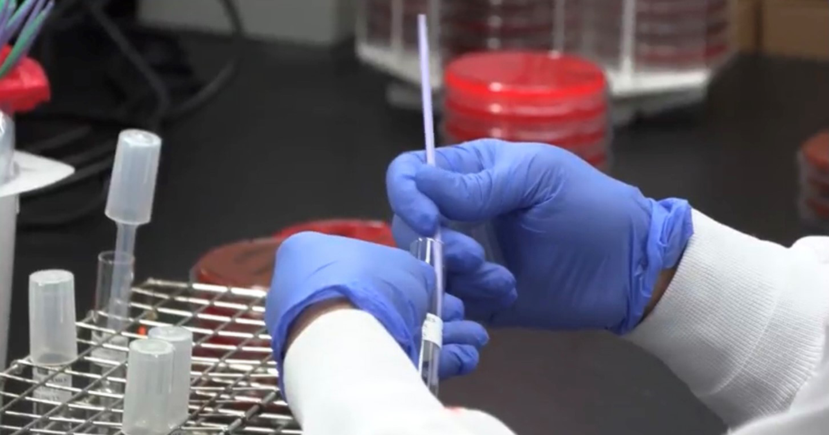 Researchers discover novel method to diagnose long COVID - Schulich ...