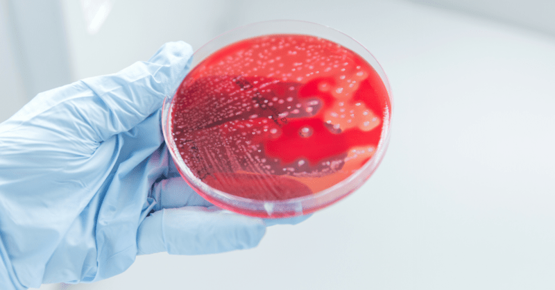 Researcher joins global network to find vaccine for often-deadly Strep ...