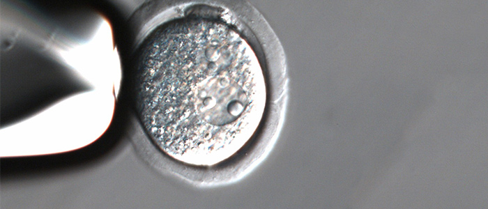 Pronuclear Injection - London Regional Transgenic and Gene Targeting ...