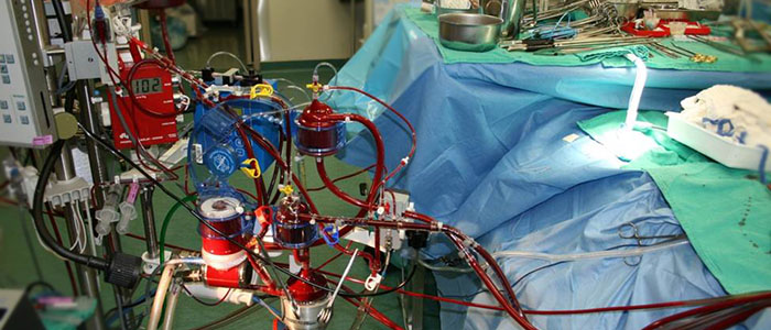 Minimally-Invasive Cardiac Surgical Procedures - Western University